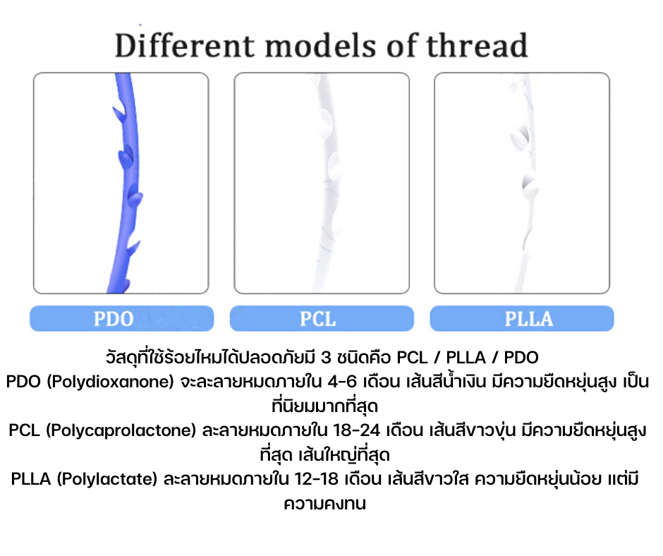 THREAD LIFT – Auramed Clinic