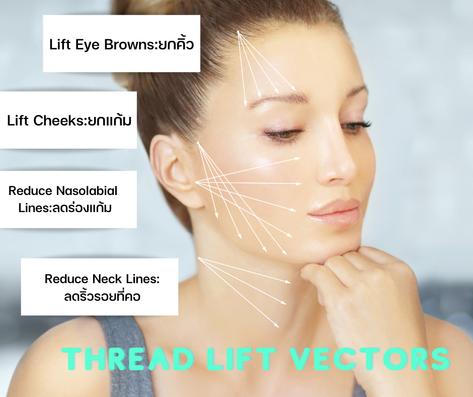 THREAD LIFT – Auramed Clinic